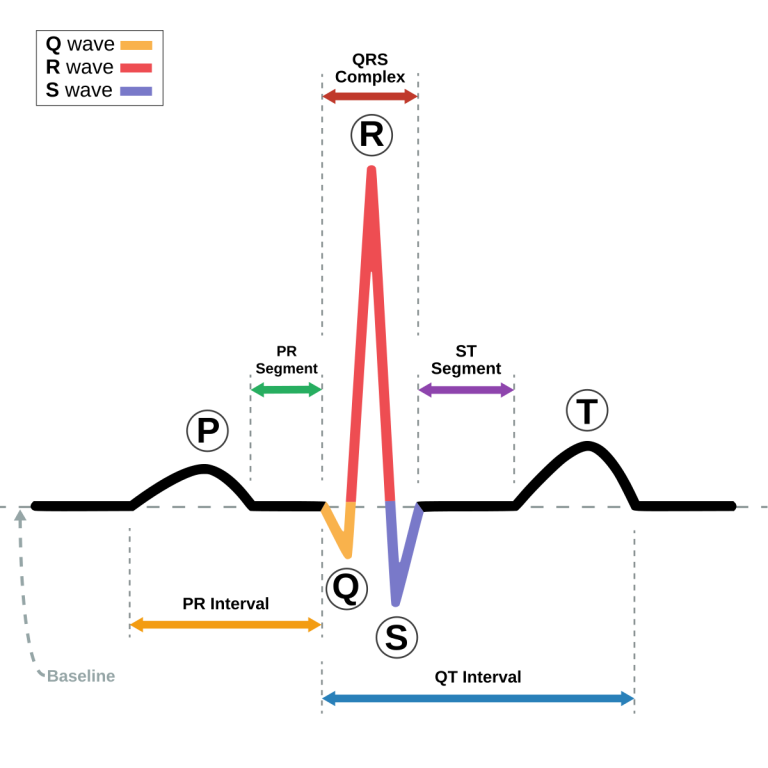 Elektrokardiografi (EKG atau ECG): Gambaran Umum, Manfaat, dan Hasil ...