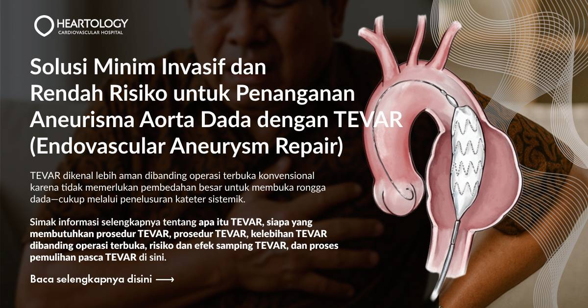 TEVAR: Solusi Minim Invasif untuk Aneurisma Aorta Torakalis