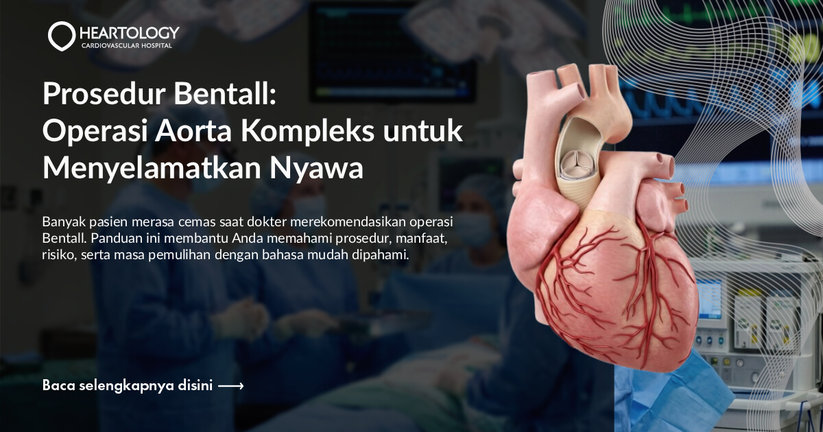 Operasi Bentall: Fungsi, Prosedur, dan Masa Pemulihan