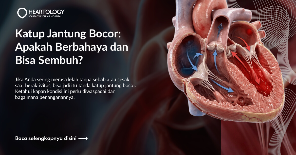 Katup Jantung Bocor Berbahaya? Gejala & Cara Mengatasinya